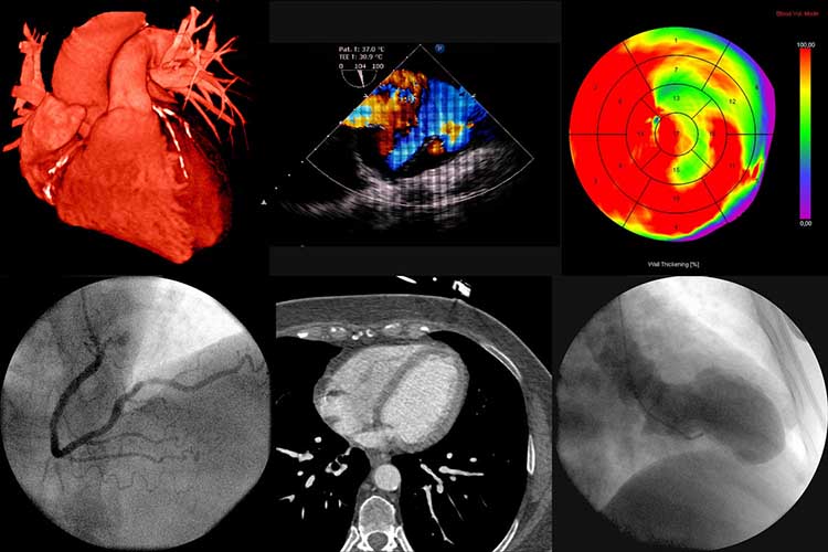 Cardiovascular Imaging in Contemporary Cardio-Oncology - Professional ...