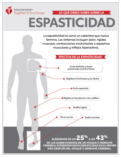Infografía sobre la espasticidad | American Stroke Association ...