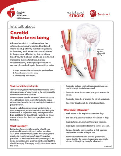 Let’s Talk About Carotid Endarterectomy | American Stroke Association